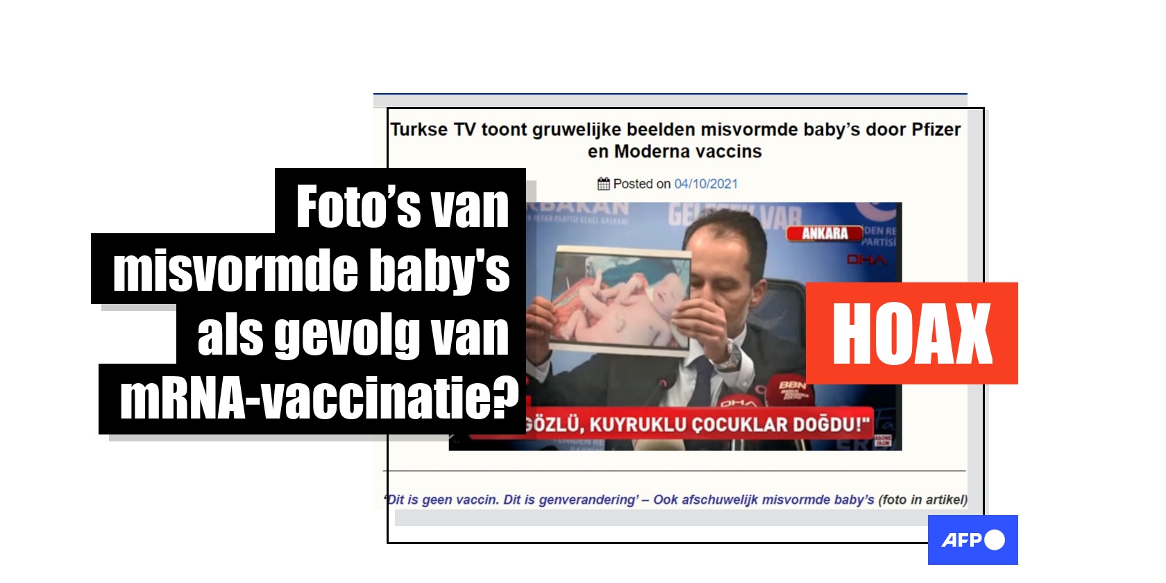 Deze foto's van misvormde baby’s hebben niets te maken met ...